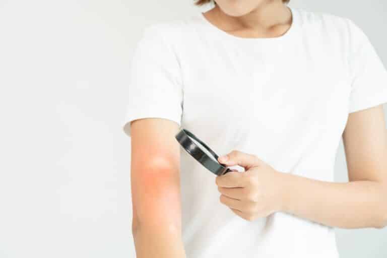 7 Common Skin Conditions And Treatments | Click2Pharmacy