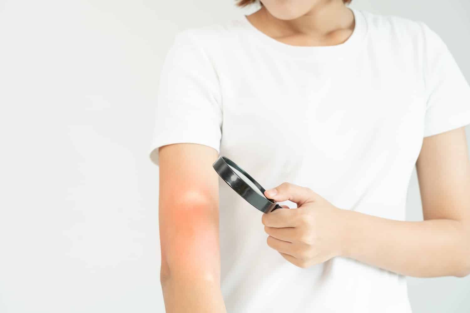 7 Common Skin Conditions And Treatments | Click2Pharmacy